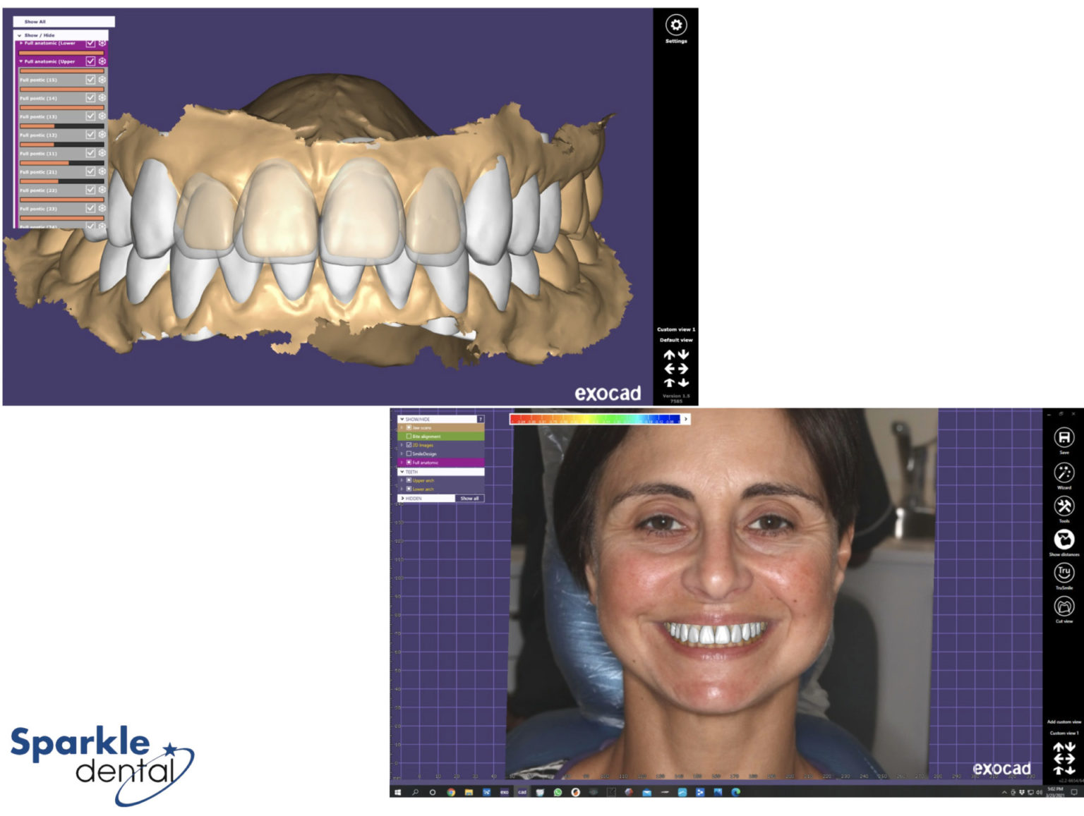 Digital Smile Design | Sparkle Dental