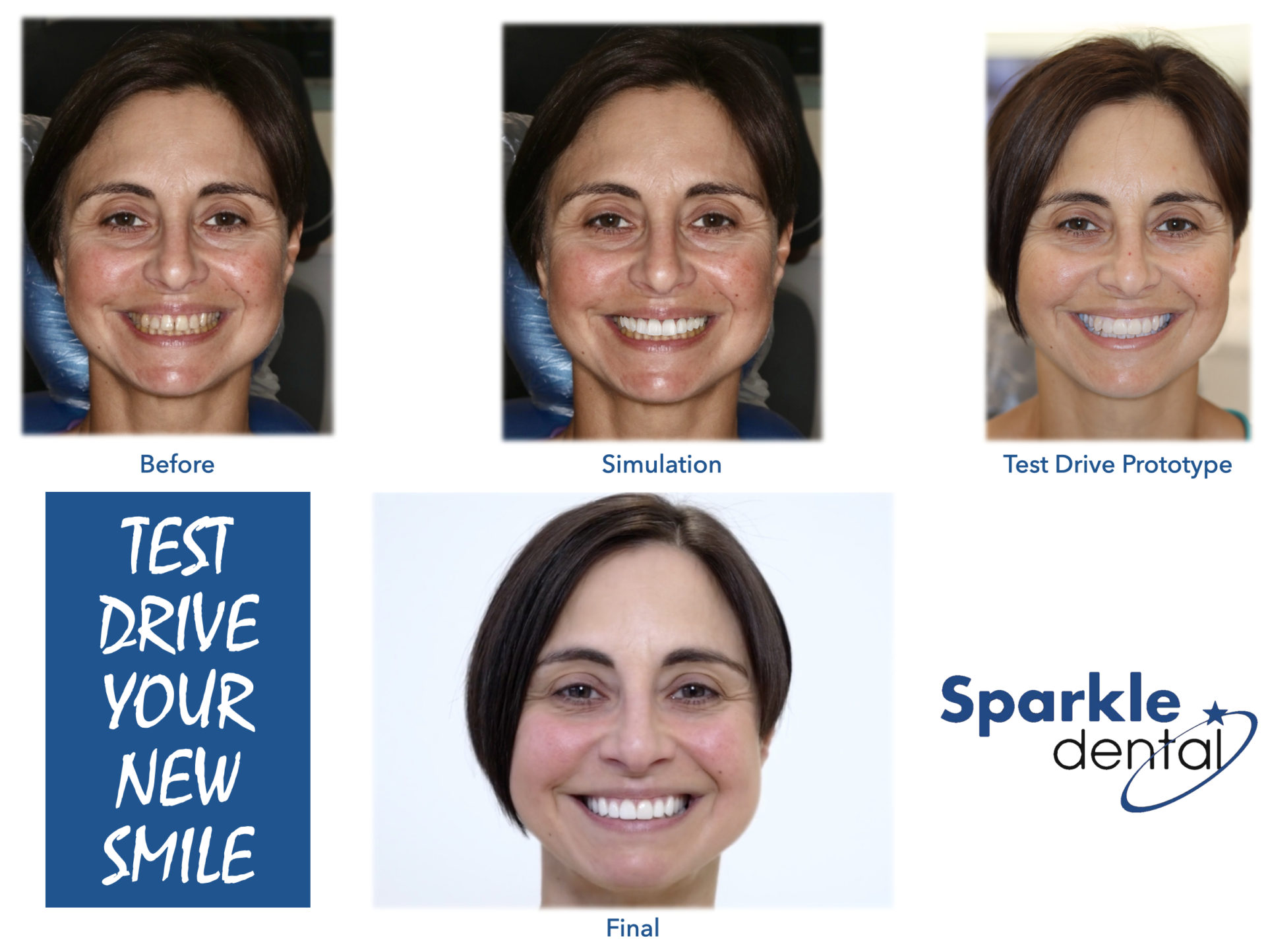 Digital Smile Design | Sparkle Dental